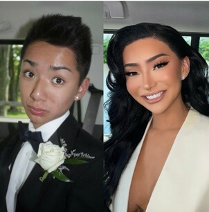 Nikita Dragun Plastic Surgery Journey- Before And After